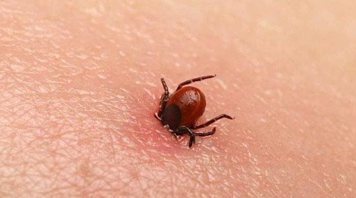 کانگو وائرس میں مبتلا ایک اور مریض بلوچستان سےکراچی منتقل